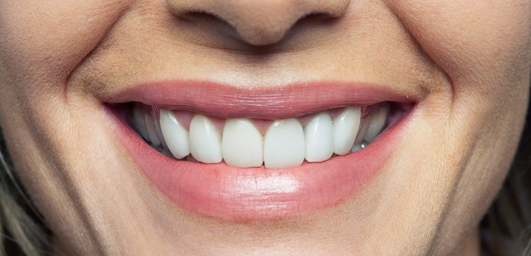 How can holistic dentistry help with your diabetes? | MediHealth DME